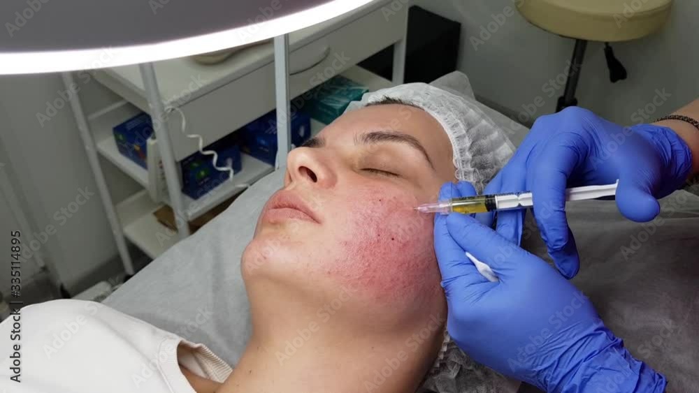 Procedure of plasmolifting to young woman at cosmetology clinic ...