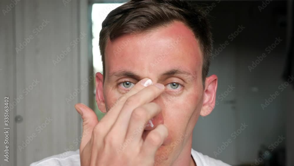 handsome man covers nose and cheeks with white burn cream looking in ...