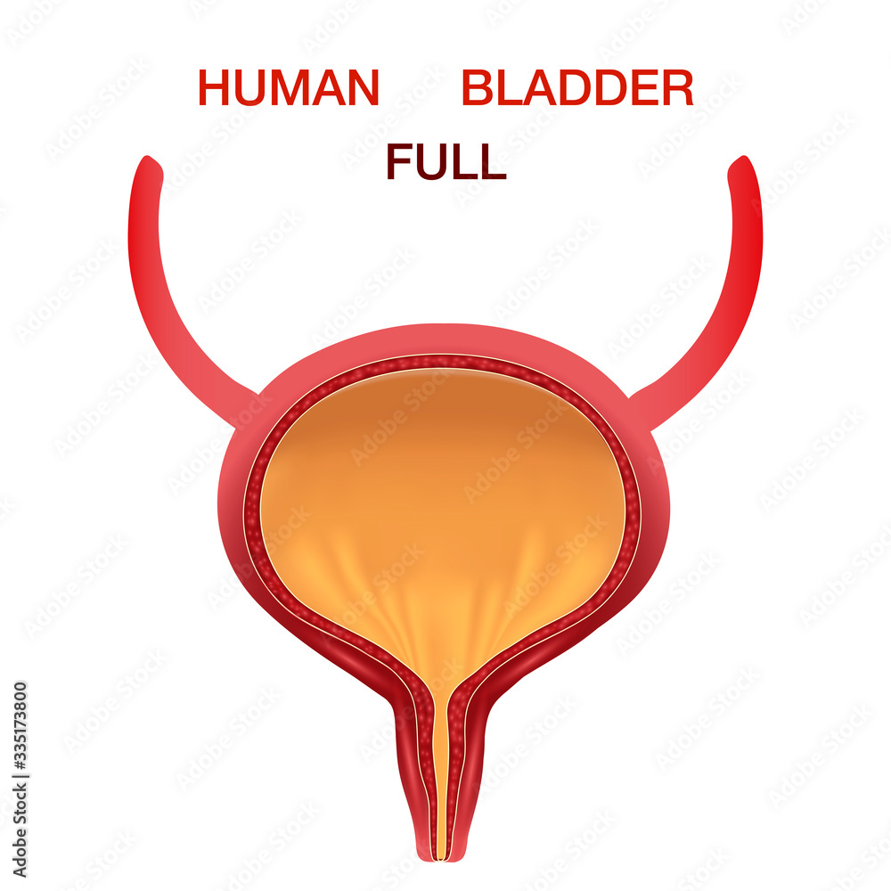 Full Urinary bladder. Human organ anatomy. Editable vector illustration ...