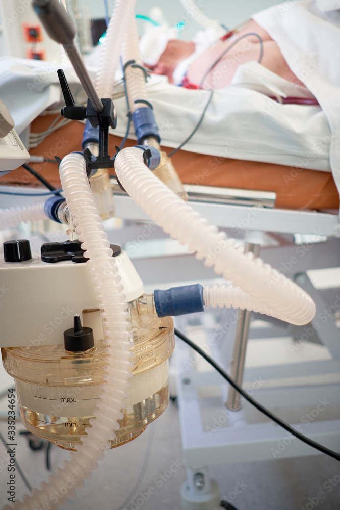 Coronavirus pandemic. Closeup view patient with coronavirus pneumonia ...