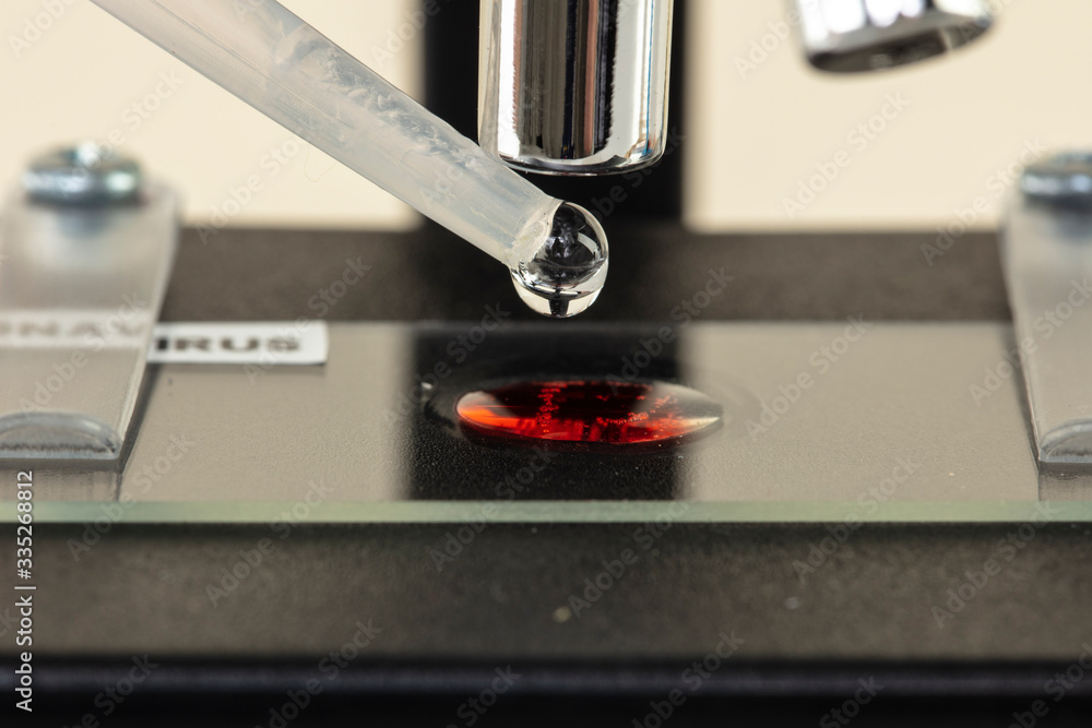 blood sample placed on a microscope slide Stock Photo | Adobe Stock