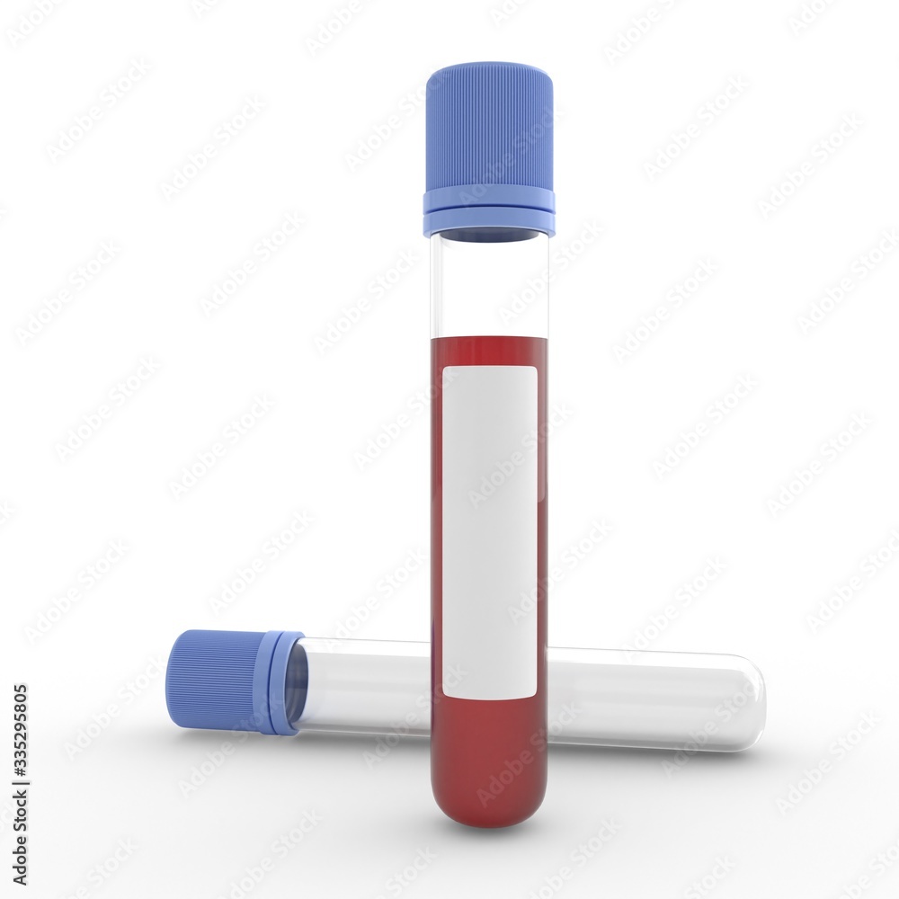 Blood analysis mockup. Test tube template. Virus diagnostic. 3d ...