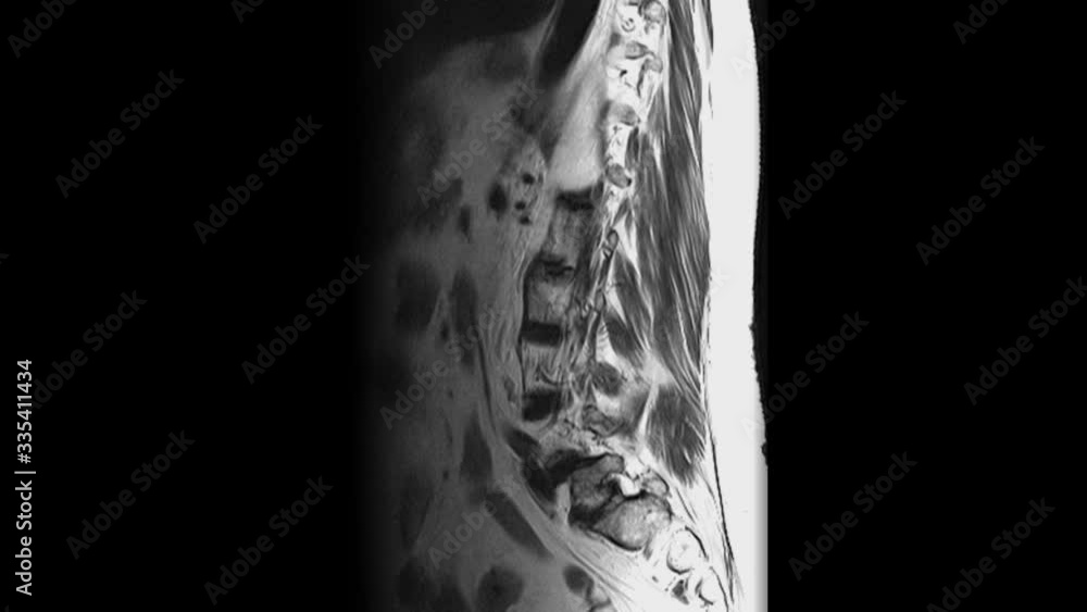 MRI of the female pelvic organs, abdominal cavity, gastrointestinal ...