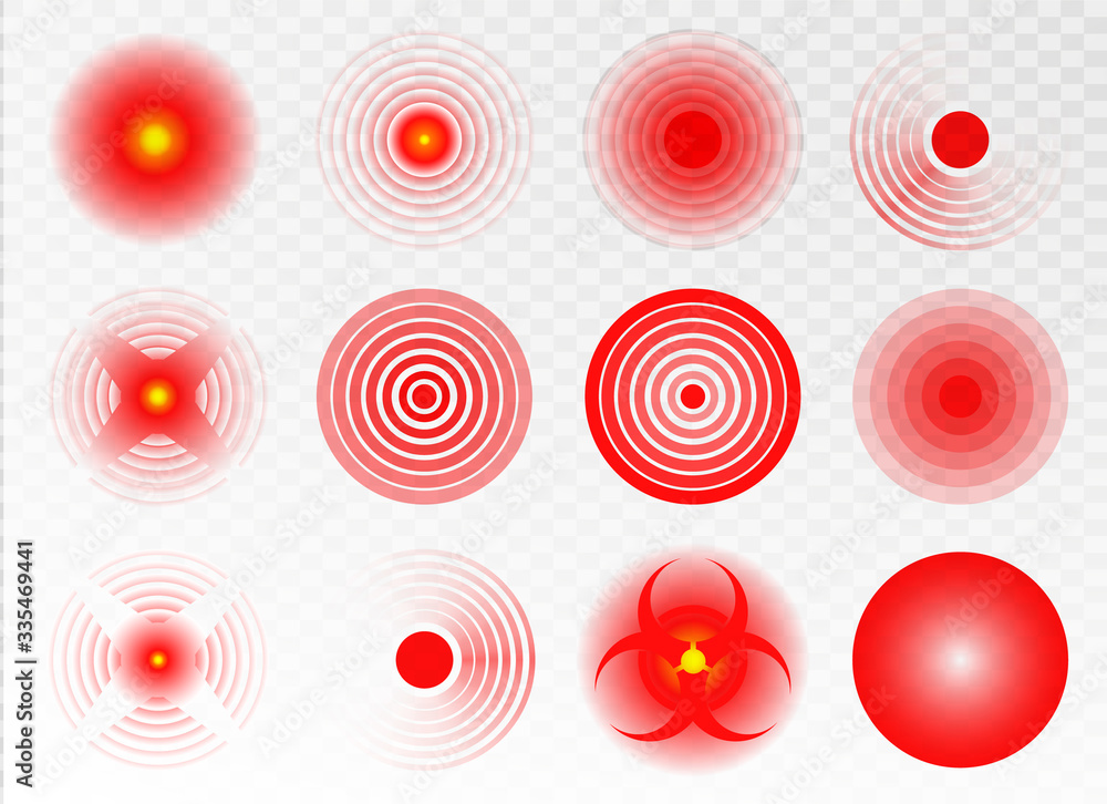 Red rings of pain to indicate localization of pain in different parts ...