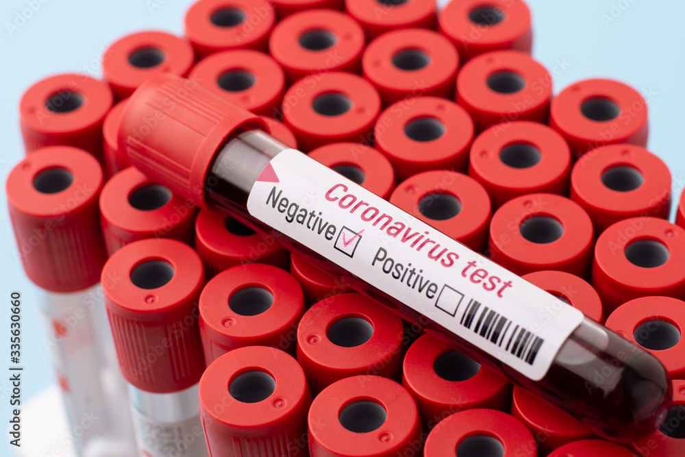Negative blood test tube on top of other tests. Concept of the end of ...