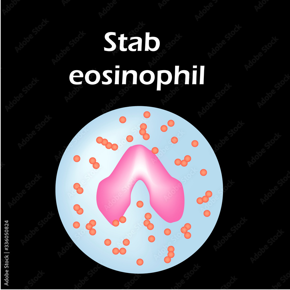 Eosinophil structure. Eosinophil blood cells. White blood cells ...