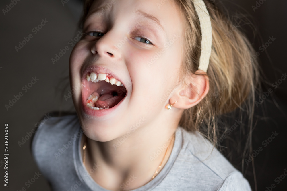 Childish cute mouth with beautiful lips and missing milk teeth dental ...