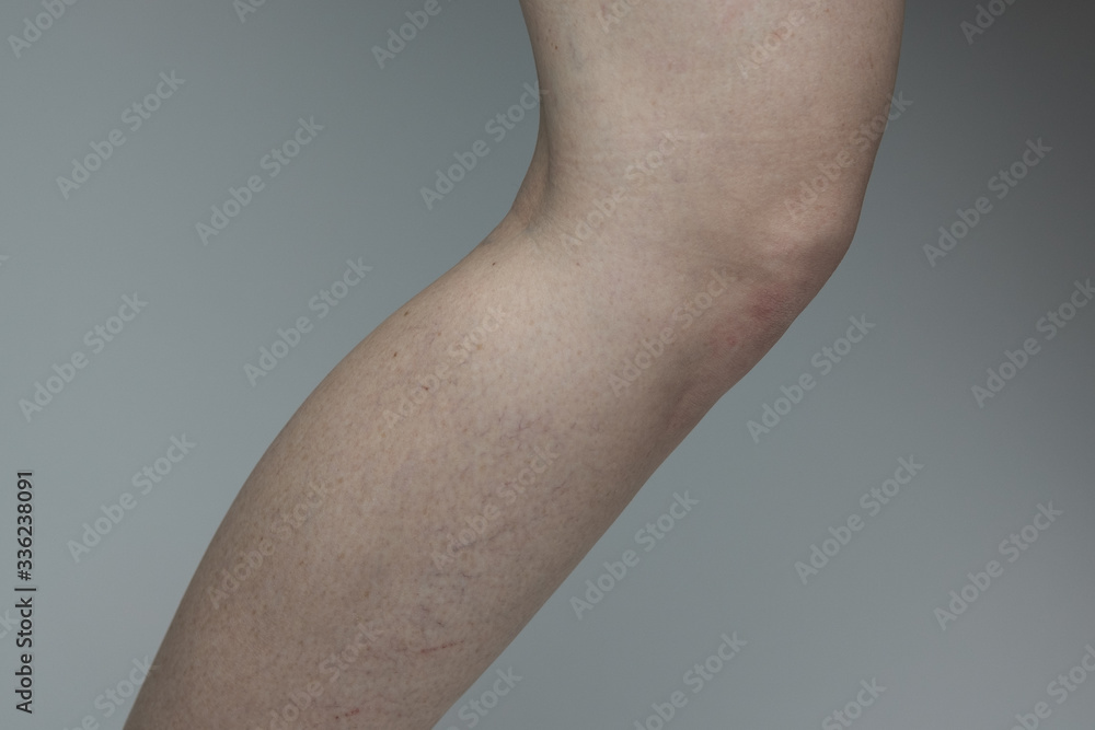 Close up of a woman slightly bending her knee against a gray background ...