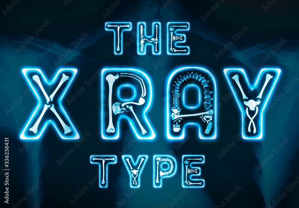 X-Ray Type Icon Set Stock Template | Adobe Stock