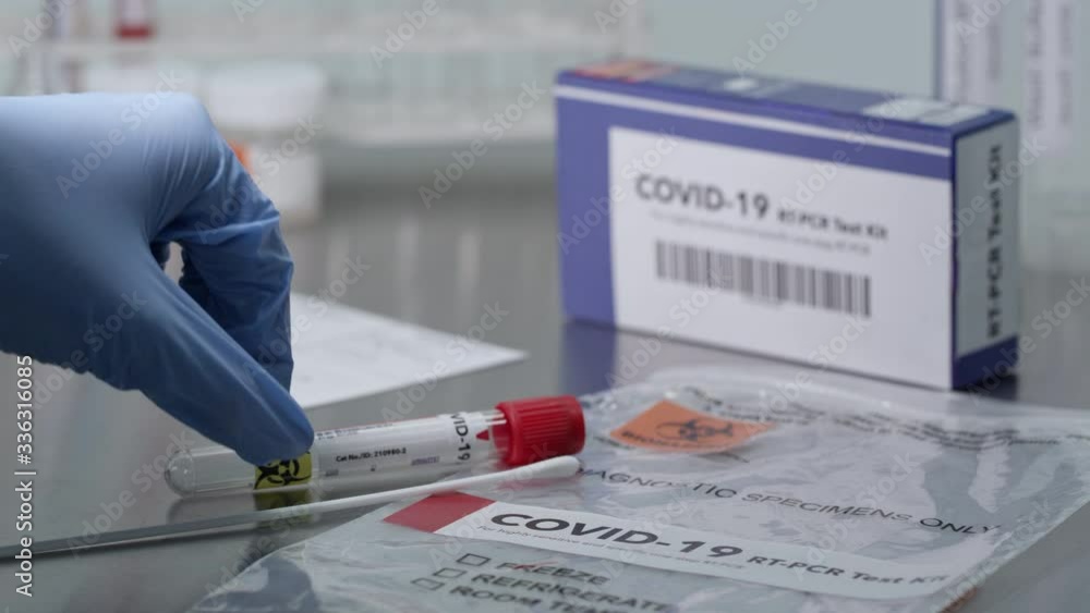 Coronavirus covid-19 test kit on lab table as swab is set next to vile ...