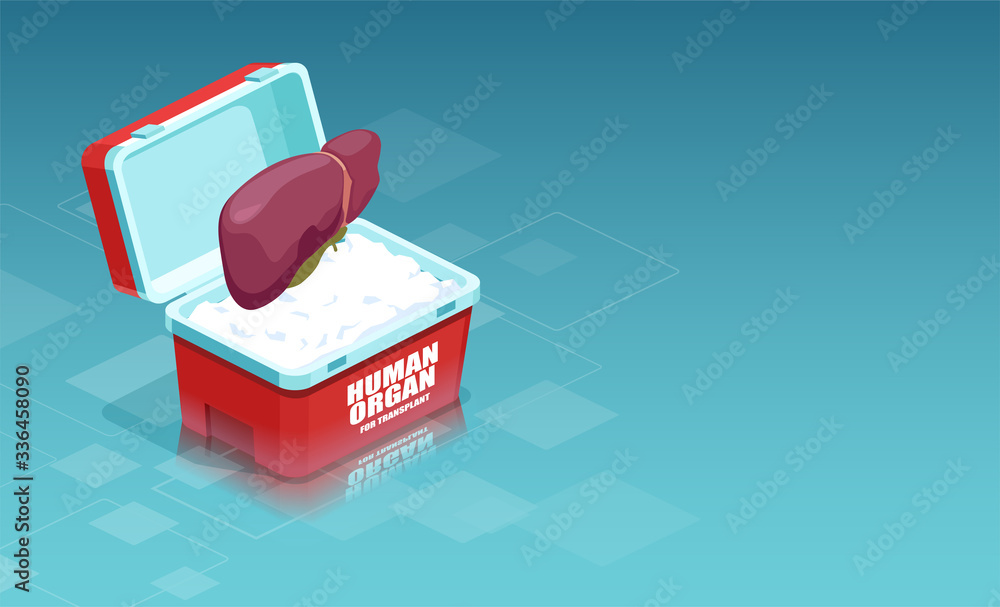 Liver transplant of a donor organ concept Stock Vector | Adobe Stock
