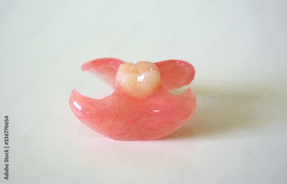 Removable denture type Butterfly on a light background. Replacement of ...