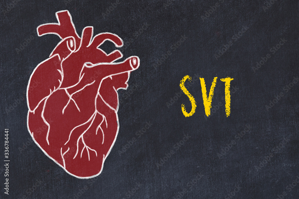 Concept of learning cardiovascular system. Chalk drawing of human heart ...