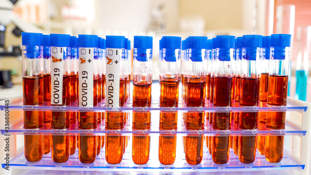 The rack of test tubes with red samples on it with positive in ...
