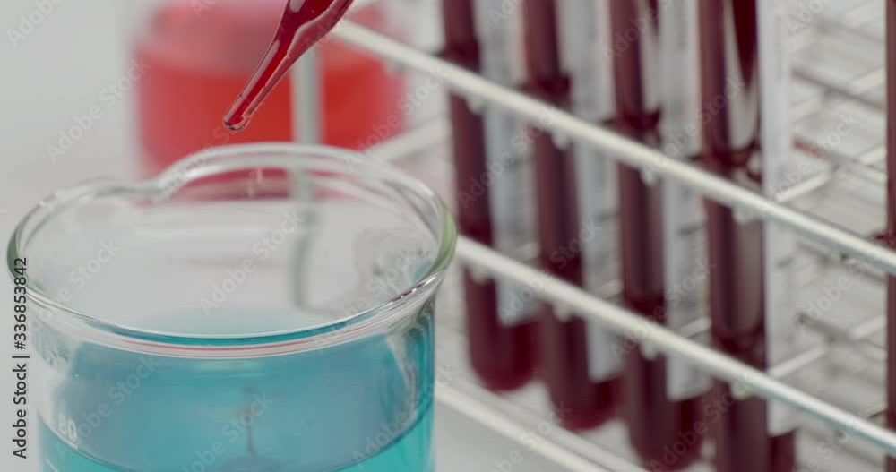 Truck shot of methylene blue test liquid with pipette drop blood sample ...