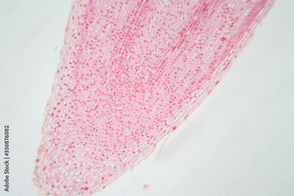 Root tip of Onion and Mitosis cell in the Root tip of Onion under a ...