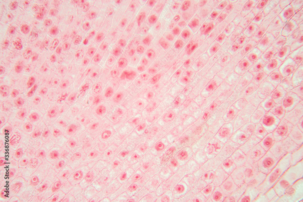 Root tip of Onion and Mitosis cell in the Root tip of Onion under a ...