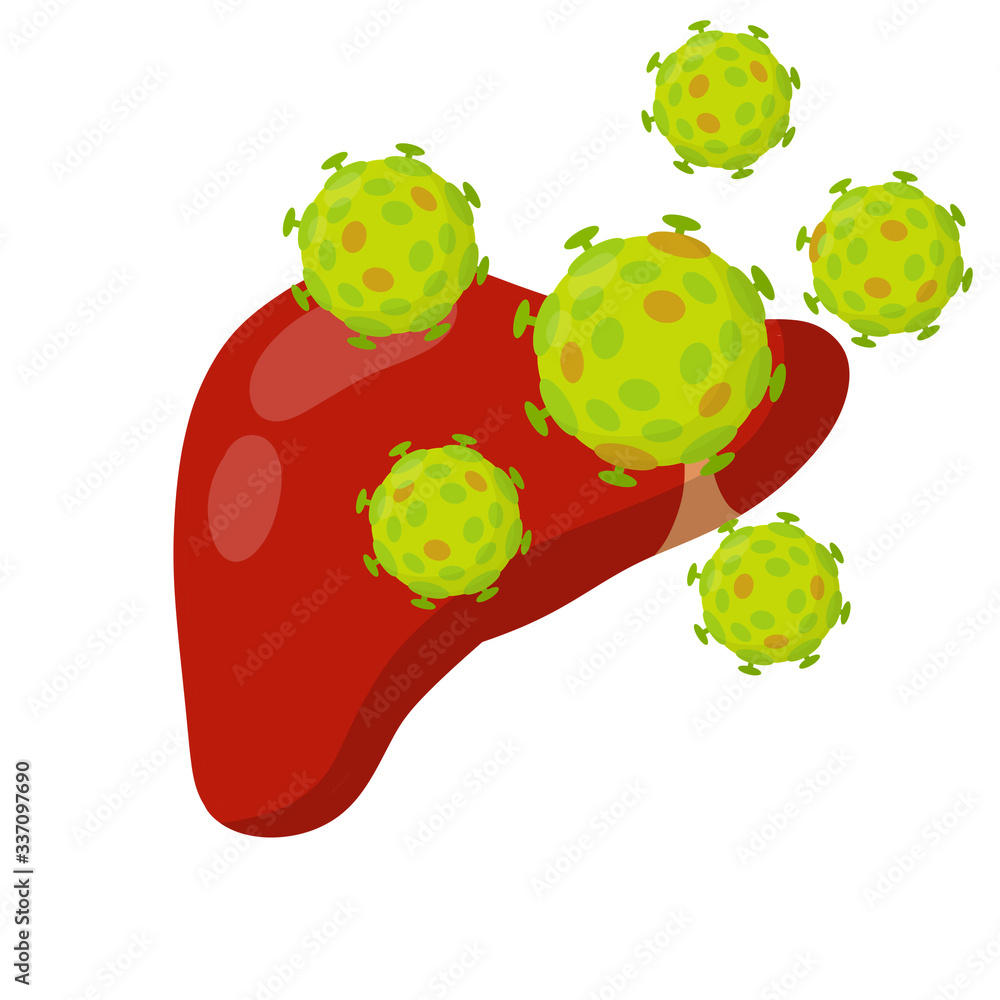 Bad liver. Attack germs and cirrhosis of the liver. Health problem ...