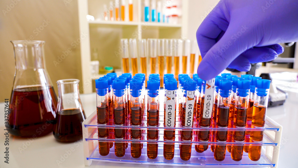 The three positive sample kit for the COVID-19 coronavirus Stock Photo ...