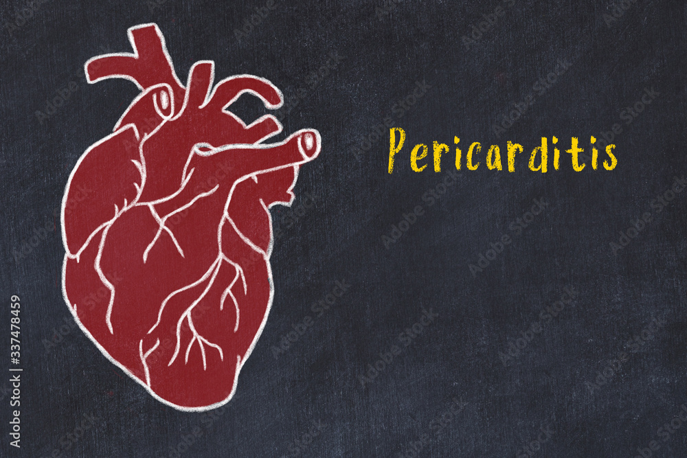 Learning cardio system concept. Chalk drawing of human heart and ...