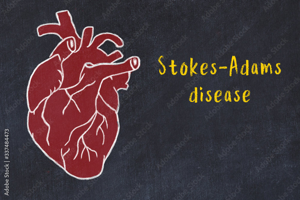 Concept of learning cardiovascular system. Chalk drawing of human heart ...
