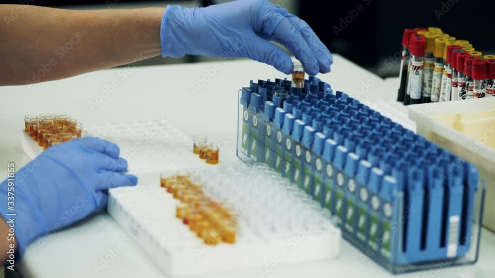 Woman puts glass tubes on a medical tray. Covid-19 test, covid-19 ...