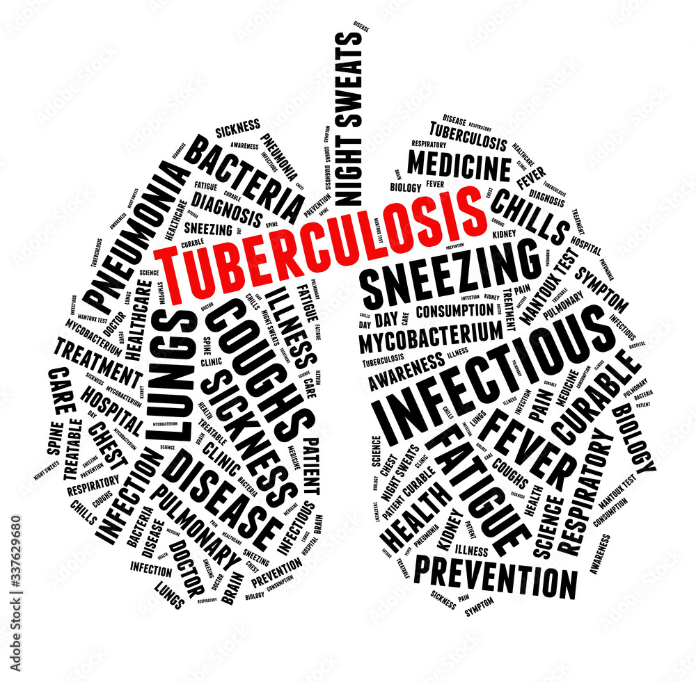 Tuberculosis lungs shape word cloud concept Stock Illustration | Adobe ...