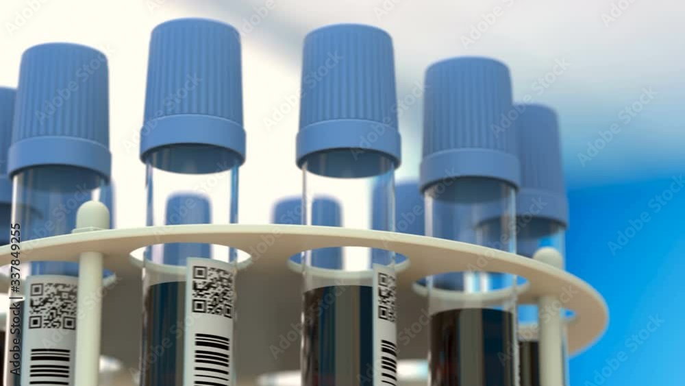 Rack with test tubes and blood samples rotates in the scientific ...