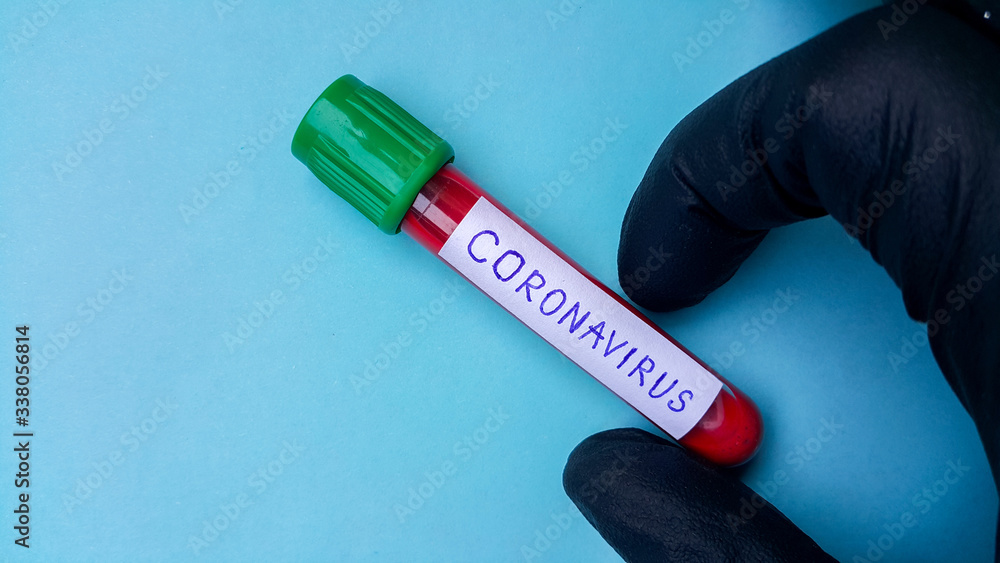 Coronavirus Covid-19 Vacuum Tubes For Medical Work With Blood Samples ...