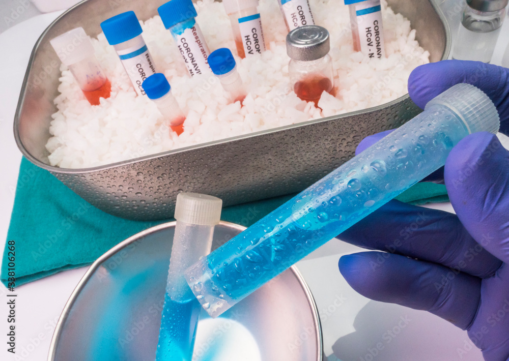 Vials with samples of SARS-COV-2 Covid-19 prepared cold in a hospital ...