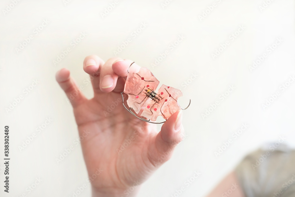 A dental plate in hand that helps align growing teeth against an white ...