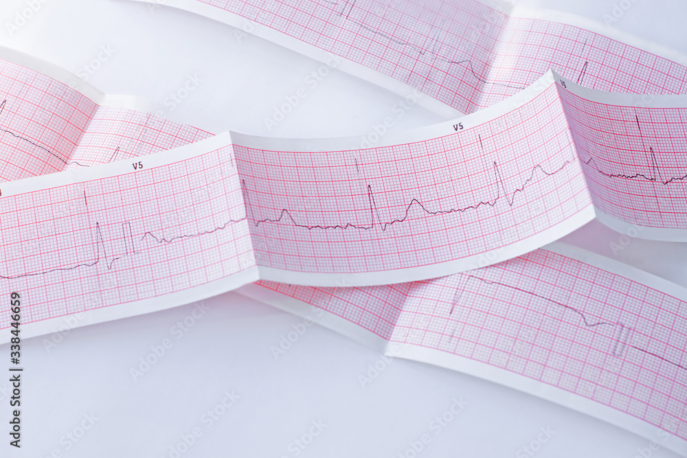 Cardiogram of young person. ECG diagram paper, medical examination ...
