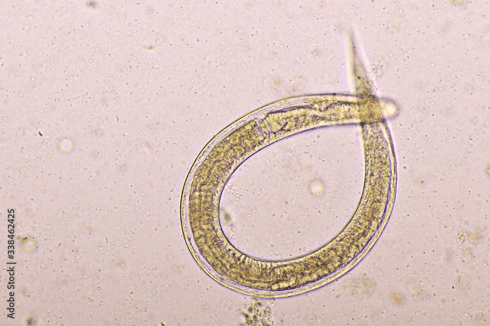 Strongyloides stercoralis or threadworm in human stool, analyze by ...