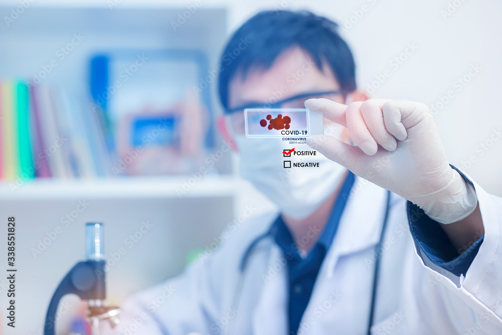 The doctor held the Covid19 sample test sheet on his hand.Positive or ...