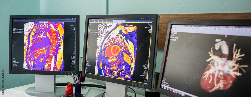 MRI CT Scanned image show on computer in DataCenter operation room ...
