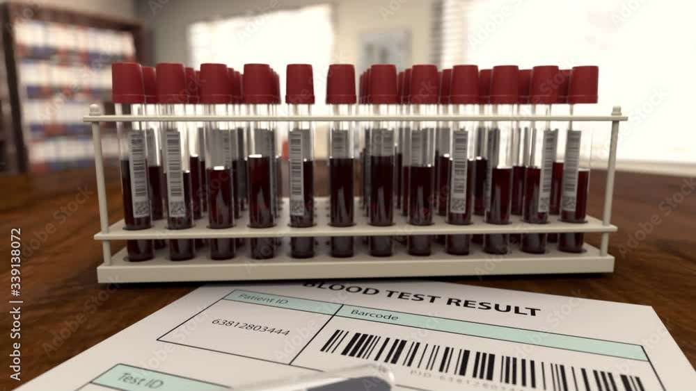 A medical form with a positive blood test result for the presence of a ...