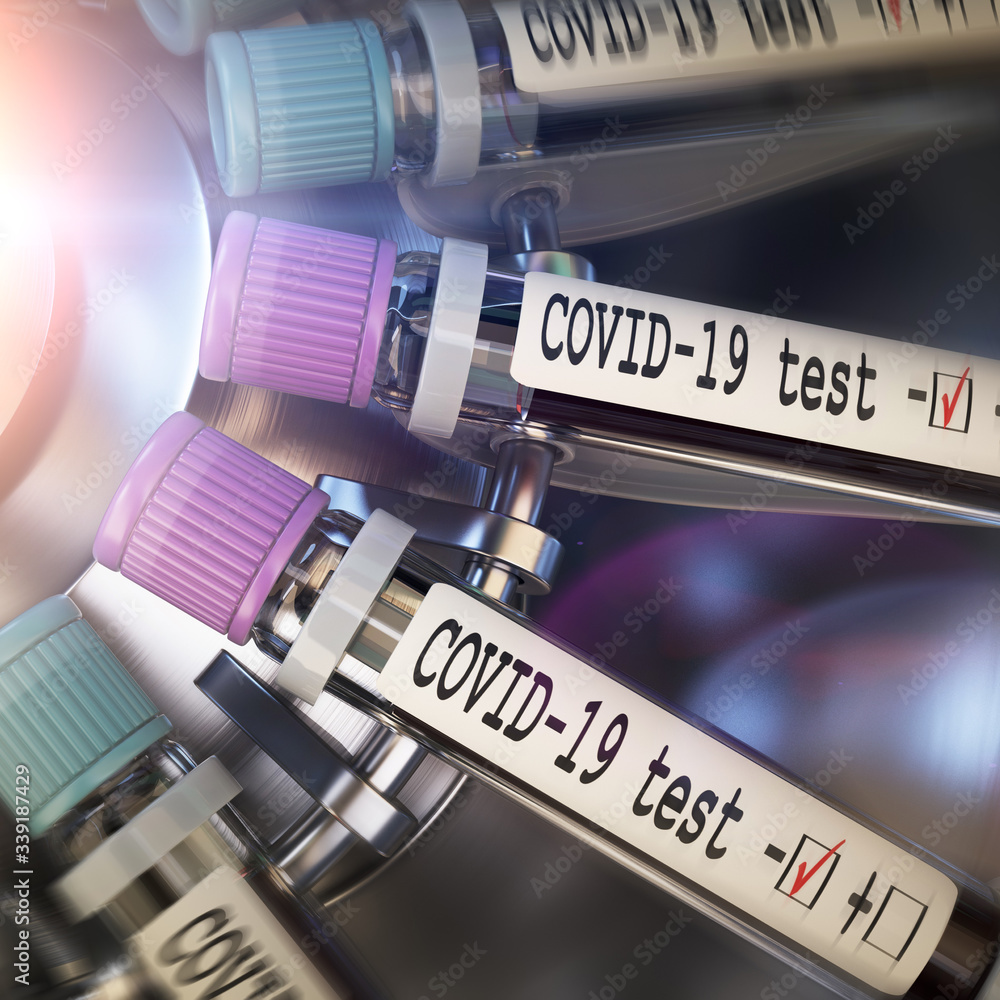 Negative COVID-19 test and laboratory sample of blood testing for ...