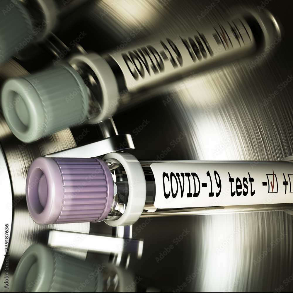 Vials of blood in a centrifuge. Negative COVID-19 test and laboratory ...