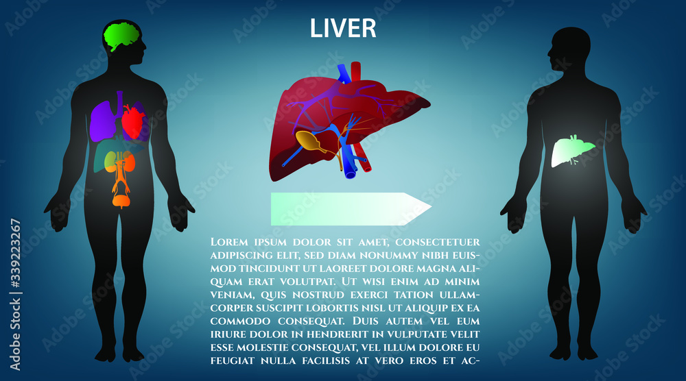 Medical illustration of organ disease. Vector medical infographics ...