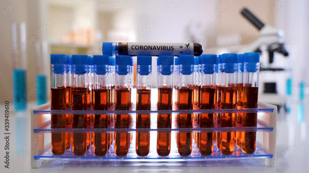 Test tubes with fluids and the coronavirus or Covid-19 sample kit on ...