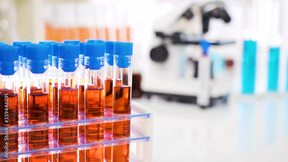 The look of the test tubes with fluids and the standing tube with the ...