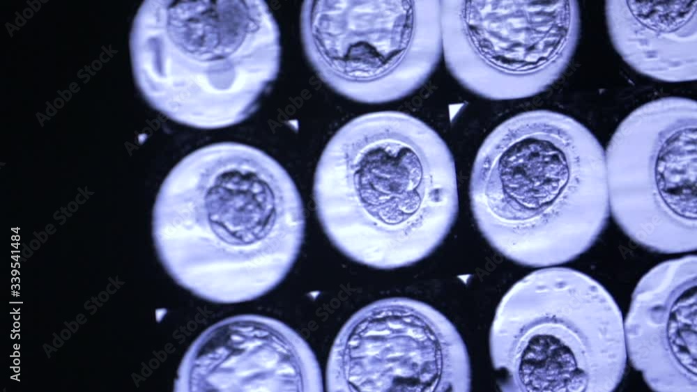 On monitor screen, photographs of stages of development of human embryo ...