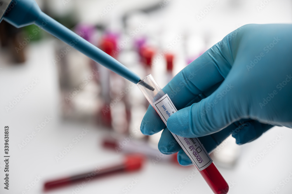 hands of a lab technician with a tube of blood sample and a rack with ...