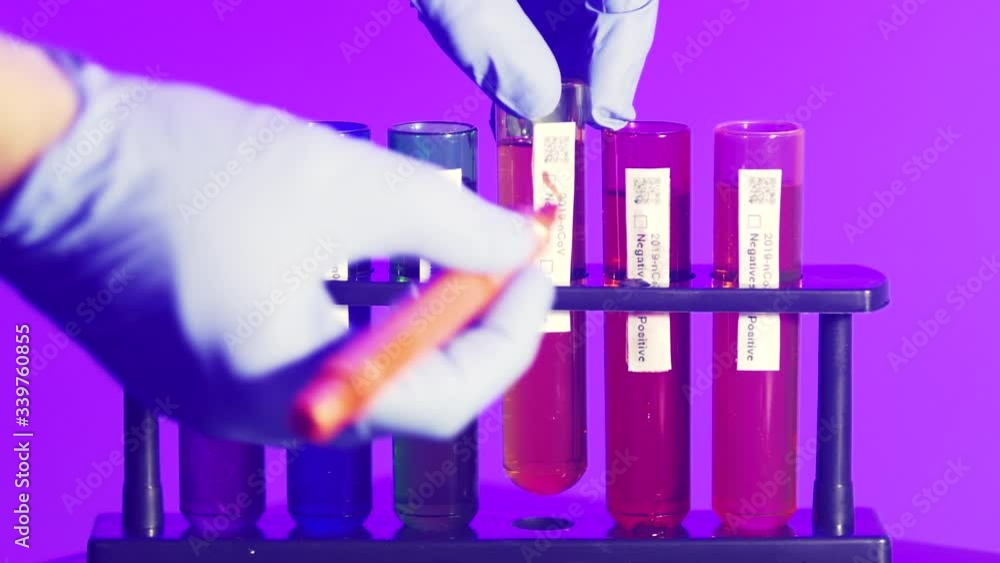 Test tubes in laboratory with different coloured tubes Liquid inside ...