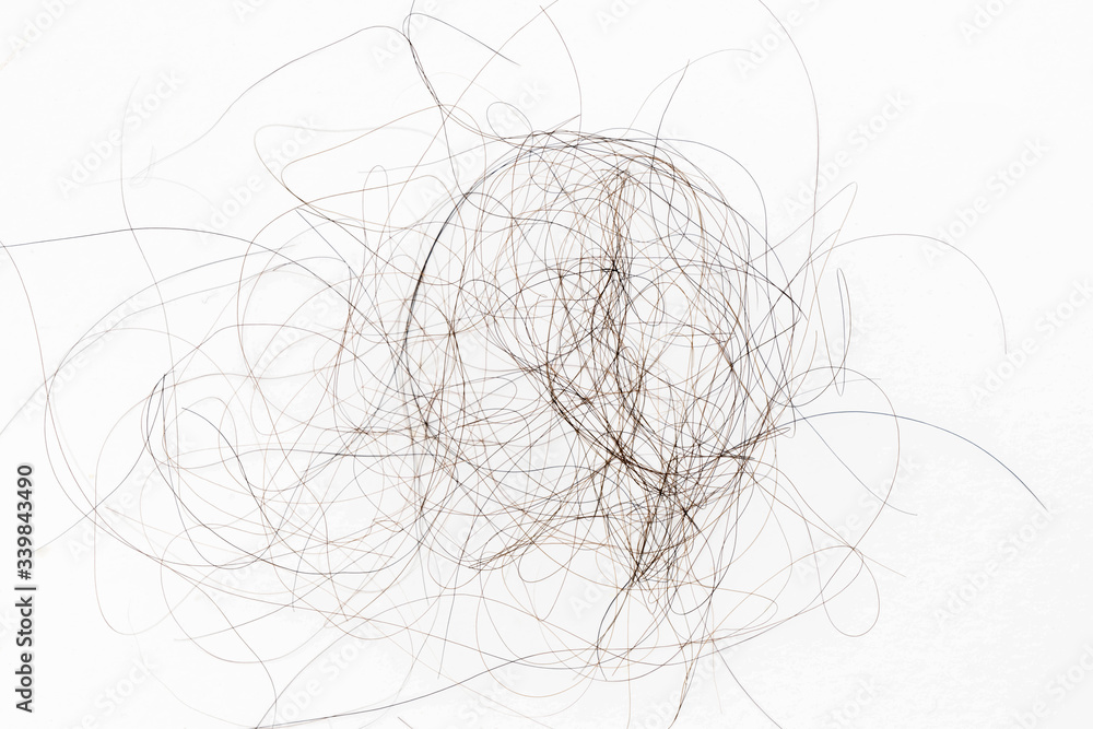 Problem of healthy with hair loss or fallen down from strain, unhappy ...