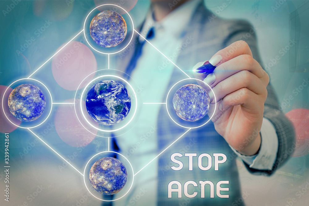Word writing text Stop Acne. Business photo showcasing control the ...