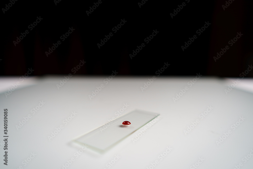 Human blood on slide glass microscope in laboratory. Stock Photo ...