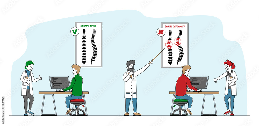 Fototapeta Vintage i Retro Spinal Deformity, Scoliosis and Spine ...