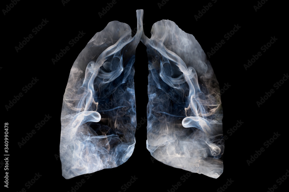Illustration of a toxic smoke formation shaped as the human lung, The ...