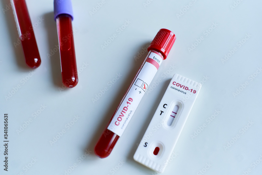 Positive test result by using rapid test device for COVID-19 virus and ...